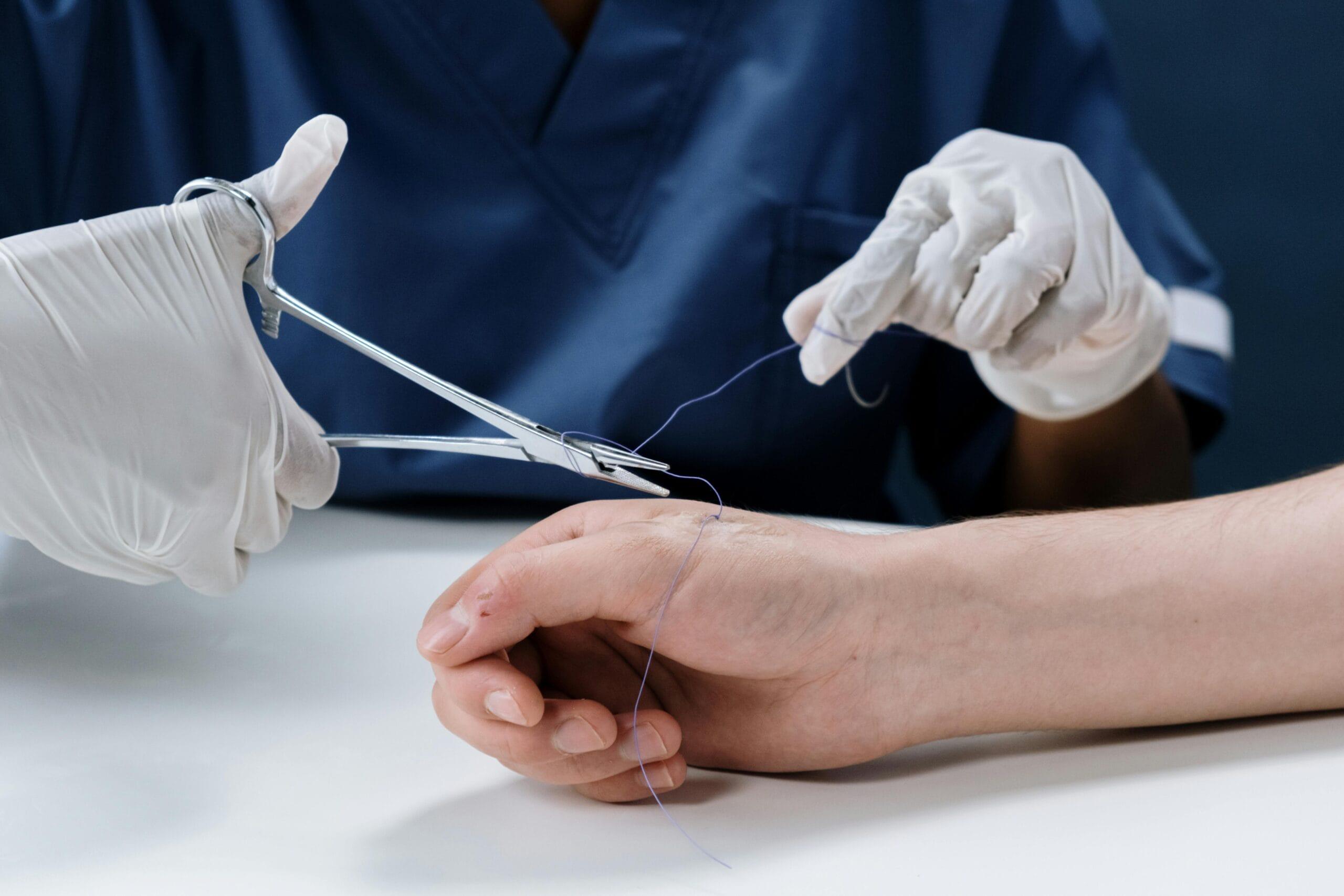 Suture Techniques: The 4 Best Methods of Wound Closure